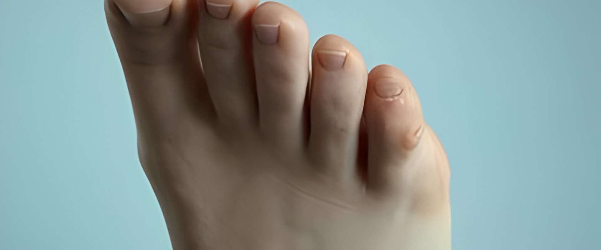 Shoes, Nerves, or Injury? Causes of Claw Toe Deformity Revealed